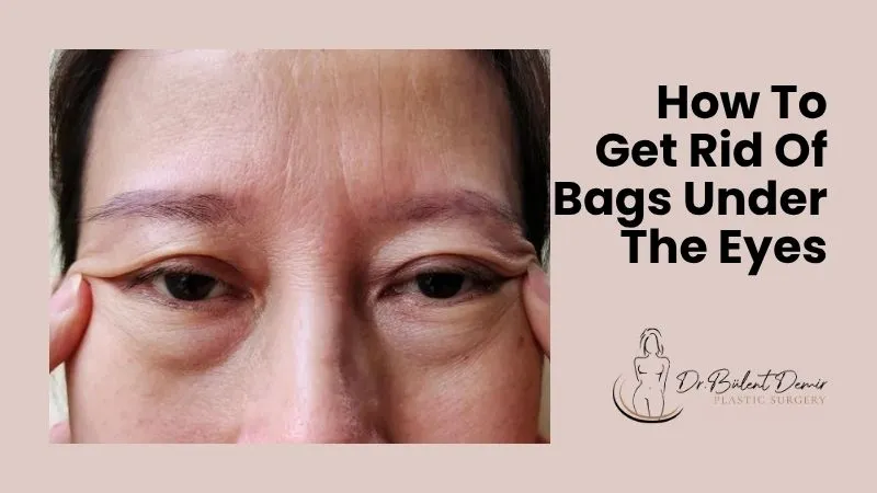 How To Get Rid Of Bags Under The Eyes